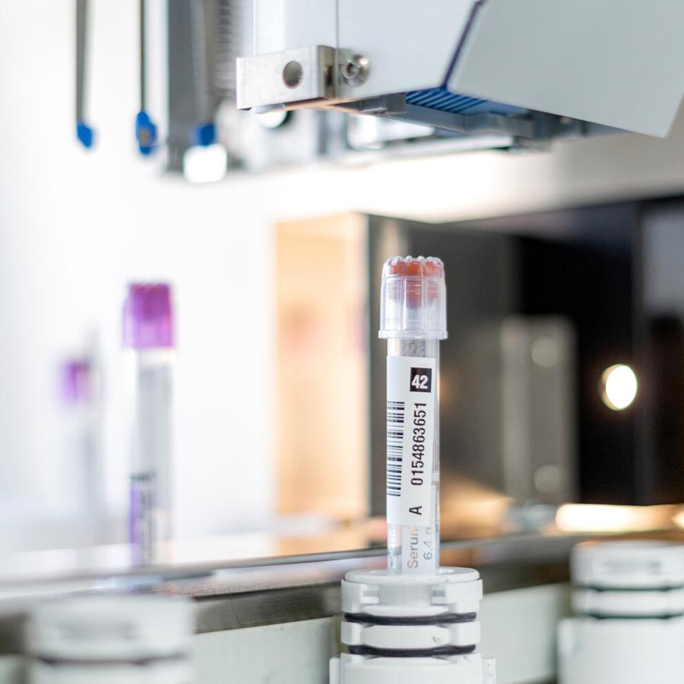 Immunhämatologische Labordiagnostik | Blutspendedienst NSTOB